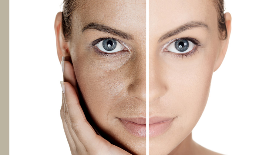 Piel luminosa y joven con Whitening Lux - Tegoder Cosmetics